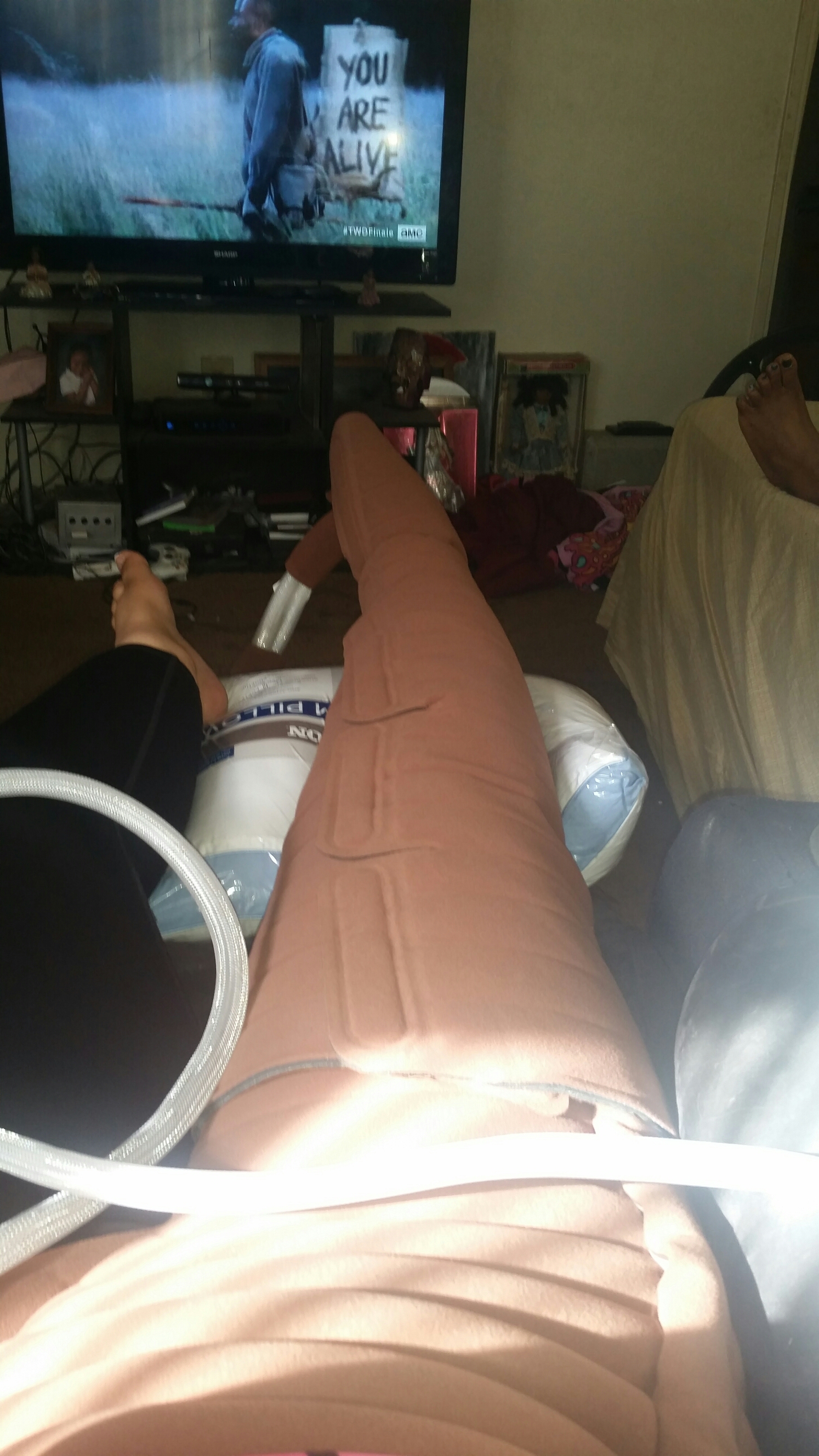 Lipedema Lady’s First Day With a FLEXITOUCH Machine! Lymphedema Therapy ...